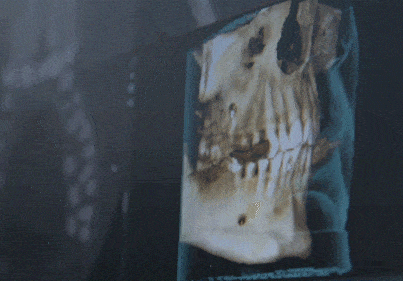 What Is a CBCT Scan and How Is It Used? | Dr. Matthew Keider