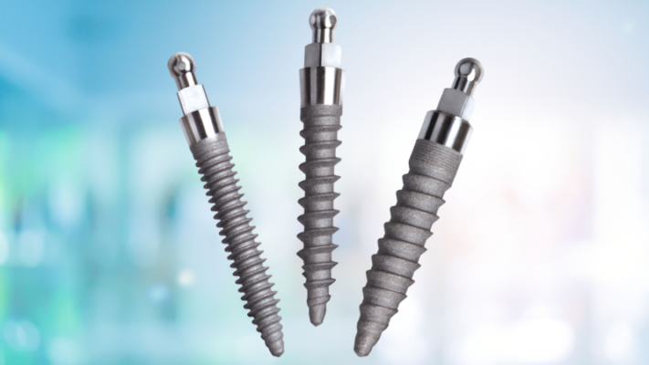 Types of Dental Implants in Winston-Salem [Video Explainer]